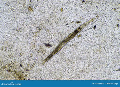 Nematode Under The Microscope Stock Image Image Of Microorganisms