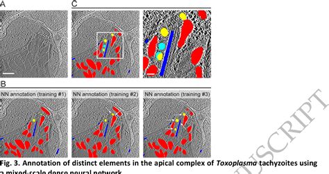 Figure 1 From Cryo Electron Tomography With Mixed Scale Dense Neural