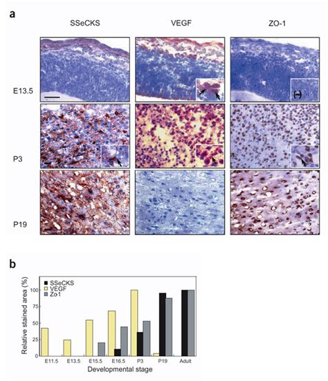 Immunohistochemical Staining Of Ssecks Vegf And Zo 1 In Developing