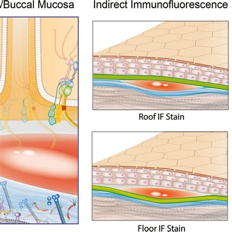 Autoimmune Subepidermal Blistering Diseases Diagnostic Diagram
