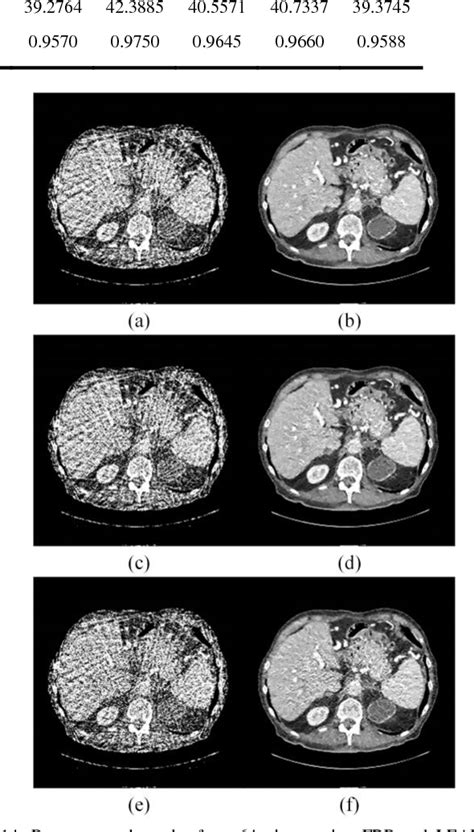 Learn Learned Experts Assessment Based Reconstruction Network For