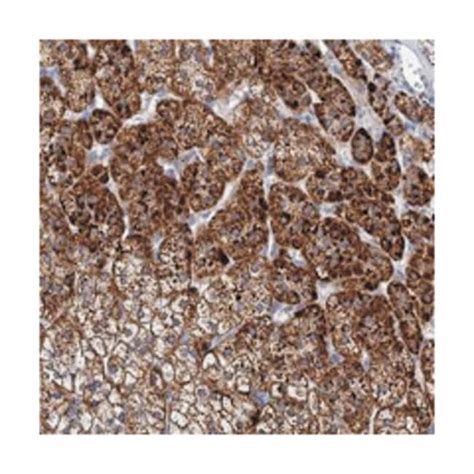 ANTI PANX2 ANTIBODY 100UL