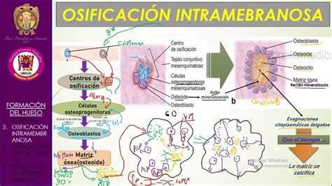 Osificaci N Endocondral E Intramembranosa Bien Explicado Youtube