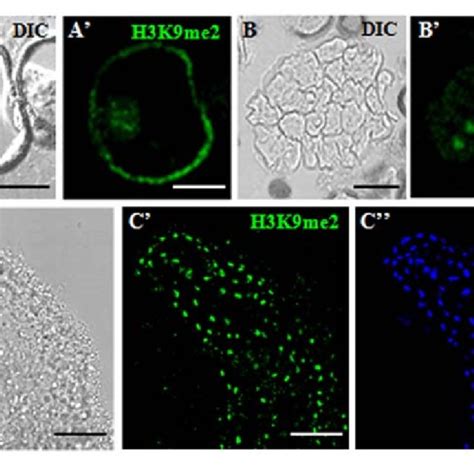 Immunofluorescence Of H3k9me2 During Microspore Embryogenesis