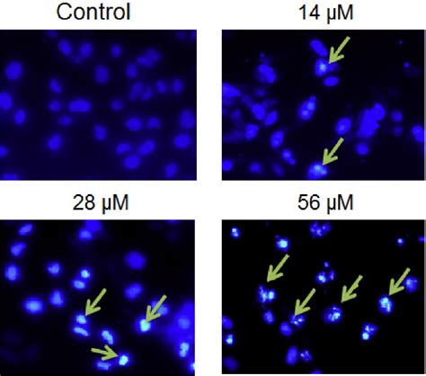 Dapi Staining Showing That Piperine Triggers Apoptotic Cell Death In