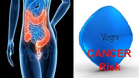 Rectal Cancer Home Remedies Rectal Cancer Symptoms Male