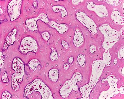 Intramembranous Ossification Light Micrograph Stock Image C052 8872 Science Photo Library
