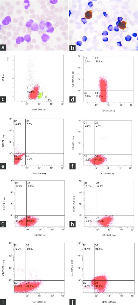 Peripheral Blood Smears And Flow Cytometry At The Time Of Detection Of