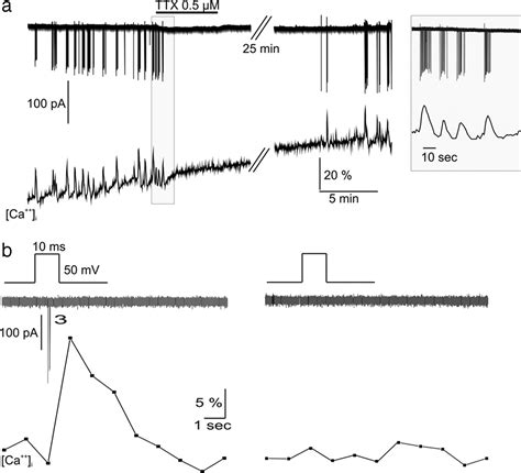Two Slow Calcium Activated Afterhyperpolarization Currents Control