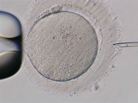 Human Egg Cell Microscope
