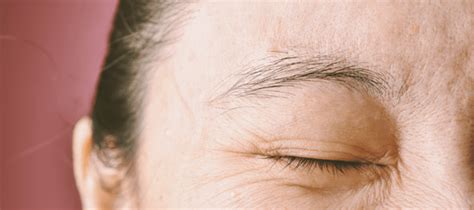 Pimple Between Eyebrows How To Get Rid Of Acne Middle Of Eyebrows