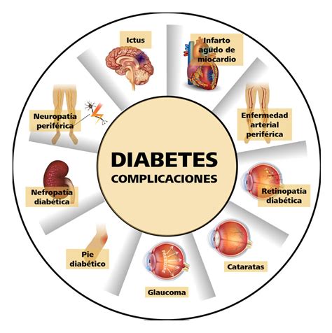 Todo Sobre La Diabetes Medicina Interna