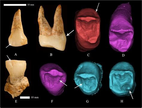 Some Morphological Traits Identified In Dushan 1 Teeth A Buccal View