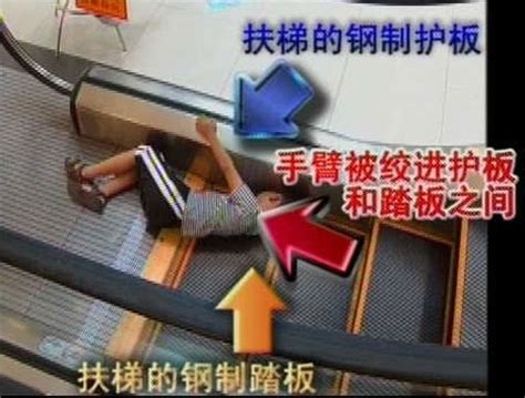 5岁男孩手臂绞进商场扶梯被迫截肢 图 新闻中心 新浪网