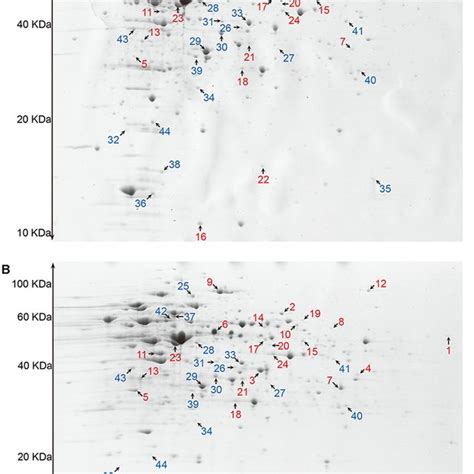 Representative 2d Gels Showing The Intracellular Soluble Proteins From