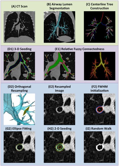 Flowchart Of The Airway Lumen Segmentation And Wall Estimation Download Scientific Diagram