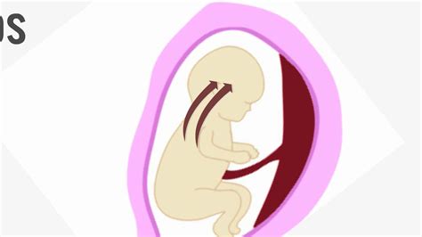 Topic 30 Postterm Pregnancy Youtube