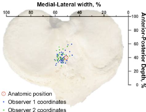 Figure 1 From Tibial Tunnel Placement In Acl Reconstruction Using A Novel Grid And Biplanar