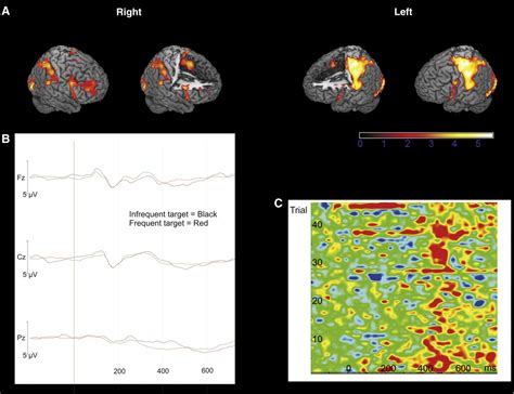 Figure 2 From Single Trial P3 Amplitude And Latency Informed Event