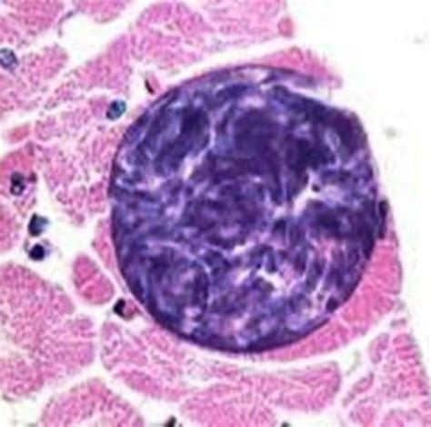 Toxoplasma Gondii Bradyzoites