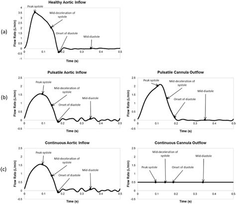A Healthy Aortic Inflow Waveform B Pulsatile Pvad Aortic And