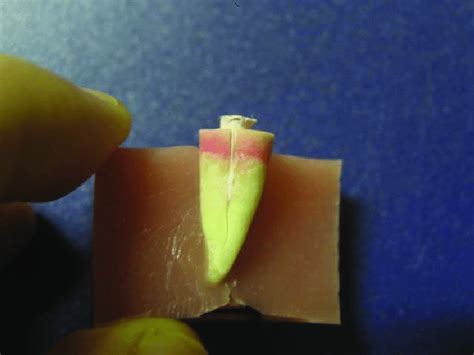Fractured Root Sample Download Scientific Diagram