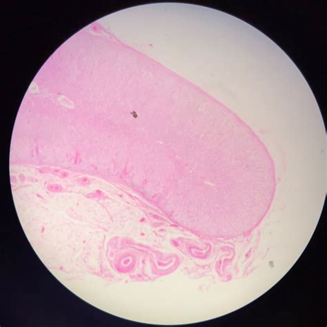 Adrenal Gland Histology Adrenal Cortex Adrenal Medulla Adrenals