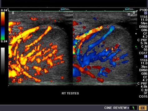 A Gallery Of High Resolution Ultrasound Color Doppler And 3d Images