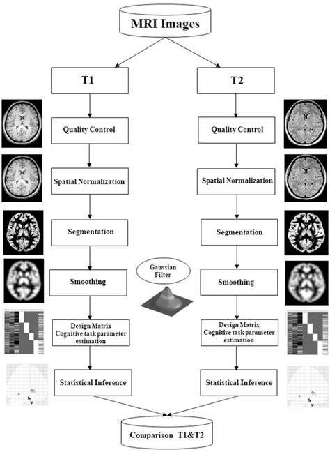 comparative analysis of voxel based morphometry using t1 and t2