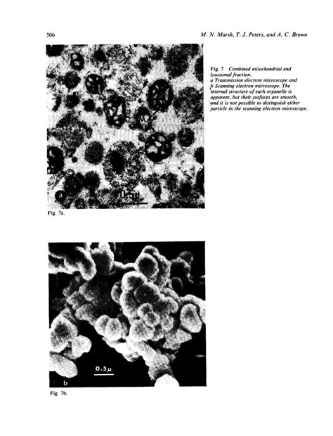 Observations Of Isolated Enterocytes And Of Their Subcellular