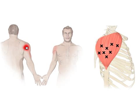 The Deltoid Muscle And Its Attachments Yoganatomy