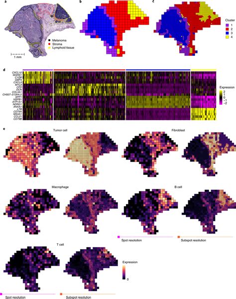 Enhanced Resolution Clustering Identifies Tumor Proximal Lymphoid