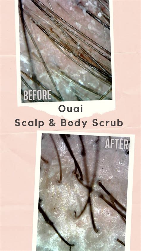Scalp Scrub Showdown Part 3 Beauty Vixen