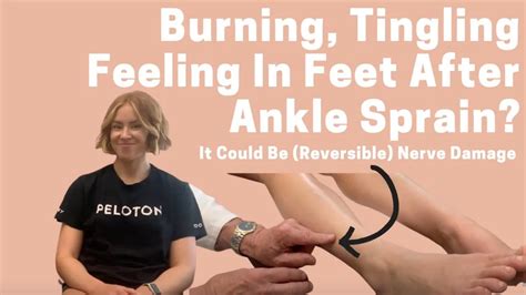 Patient Got Rid Of Burning Tingling Feet After Ankle Sprain With This