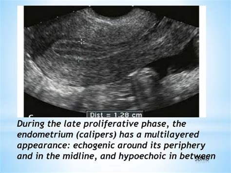 Drnazarinormalpelvicultrasoundpdf Pregnancy Reproductive Health