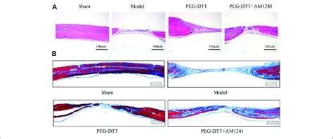 Histological Staining Images A Hande Staining B Masson Staining