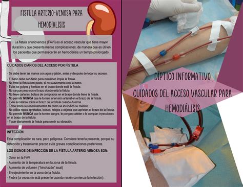 Diptico cuidado del cateter Hemodialisis parte 2 Díptico Informativo