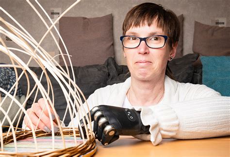 Taska Prosthetics Taska Champions