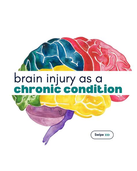 Massability Massabilityma • Instagram Photos And Videos