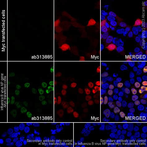 Anti Influenza B Virus Nucleoprotein Antibody Epr28205 27 Ab313885