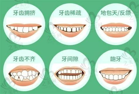 口腔医院诊疗技术牙科医院手术方案之美网