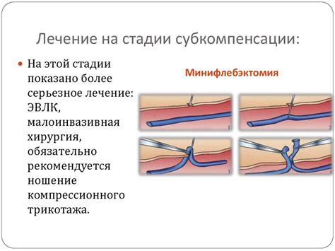Лечение варикозной болезни и облитерирующего атеросклероза вен нижних