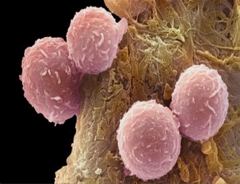 10 Alimentos Que Combaten El Cáncer Ejutv