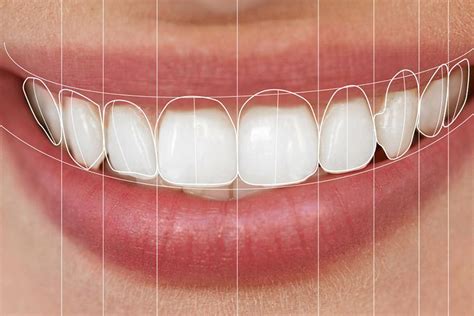 Digital Smile Design Fashion Beauty Blog