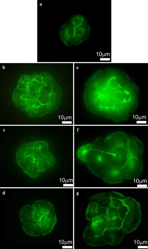 Fluorescence Microscopy Analysis Of F Actin Organization In Hacat Cells