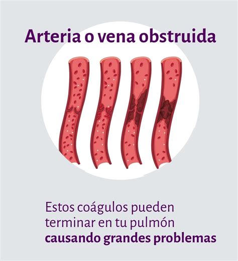 13 De Octubre Día Mundial De La Trombosis