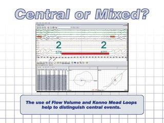 Flow Volume Loop Quick Loop Guide PPT