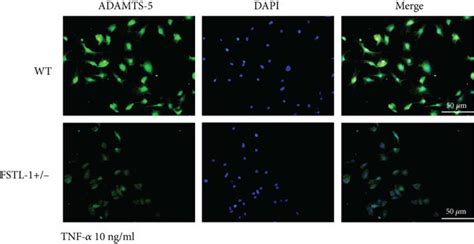 Knockdown Of Fstl 1 Reduced Tnf α Induced Inflammatory Cytokines In