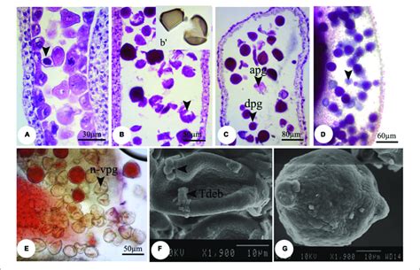 Observed Modifications Of The Microsporogenesis Process In Bean Download Scientific Diagram