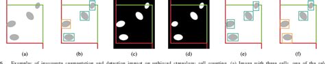 Figure From A Review Of Nuclei Detection And Segmentation On Microscopy Images Using Deep